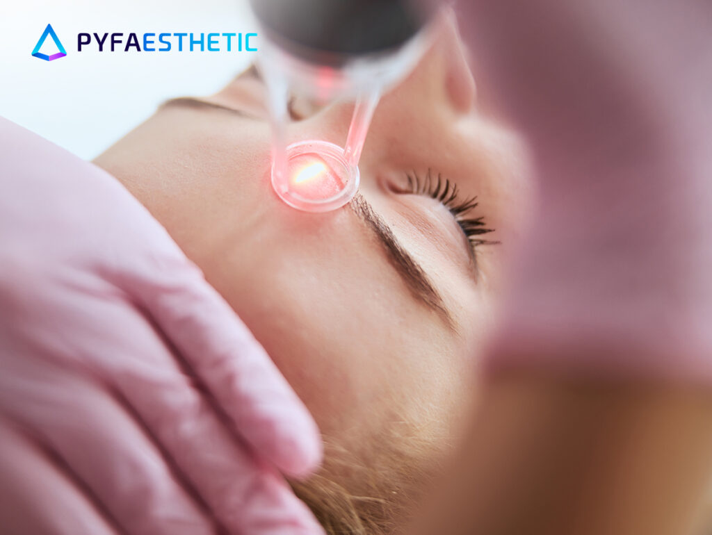 Kenali Keunggulan Terapi CO2 Tanpa Suntik untuk Kulit - Pyfaesthetic